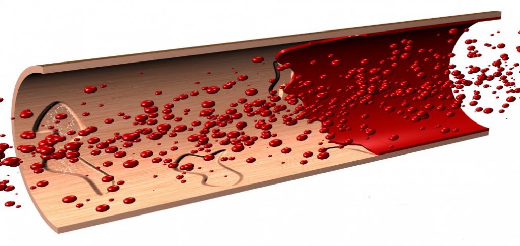 Redline Pipe Relining - Steel and Copper Pipe Repair | Nuflow